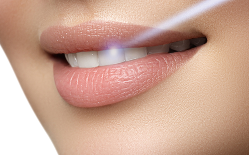 Dévitalisation dentaire Paris 15 - Dr Jonathan Revah